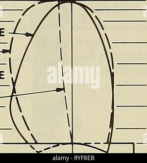 The effects of hull pitching Stock Photo - Alamy