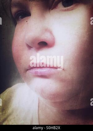 Misery: a swollen face from an abscessed tooth (2 Stock Photo - Alamy