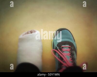 Foot in plaster, feet in wheelchair Stock Photo: 34380948 - Alamy