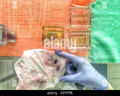 Hospital pathology lab. Close-up of a microbiologist collecting samples ...