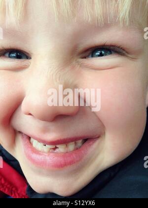 Child shows missing teeth. Child face Stock Photo - Alamy