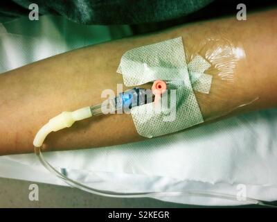 Patient's arm with IV drip Stock Photo - Alamy