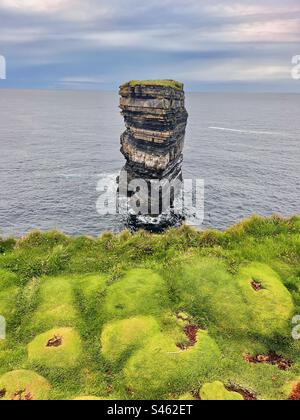 The Dun Briste Sea Stack Off The Cliffs Of Downpatrick Head In County ...