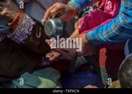 A young patient seen with leeches on her foot during the leech therapy ...