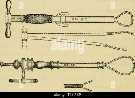 . ECRASEUR (or NEW INSTRUMENT FOR CASTRATING COLTS.) No clamps, no ...