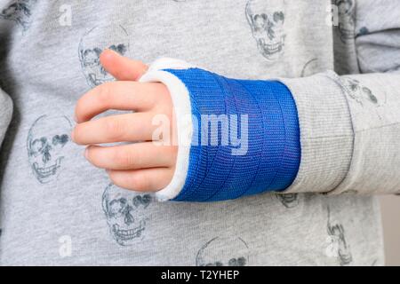 Symbol picture, wrist with plaster cast, Germany Stock Photo - Alamy
