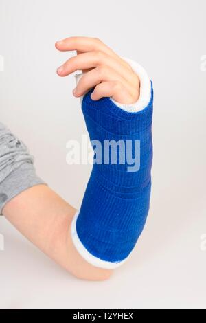 Symbol picture, wrist with plaster cast, Germany Stock Photo - Alamy