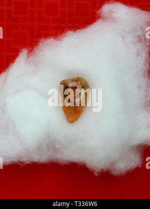 Human wisdom tooth isolated on gray background. Dentistry concept ...