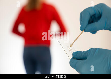Cervical cancer, cervical carcinoma, smear after an examination of the ...