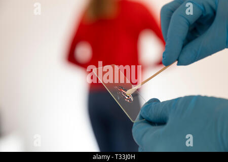 Cervical cancer, cervical carcinoma, smear after an examination of the ...