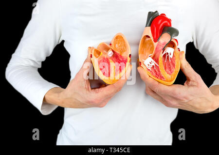 Model of a human body with open chest and visible organs - anatomy ...