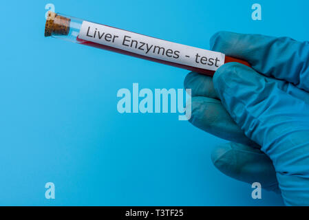 Liver Enzyme - Test with blood sample. Top view isolated on office desk ...