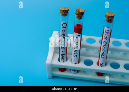 Liver Enzyme - Test with blood sample. Top view isolated on office desk ...