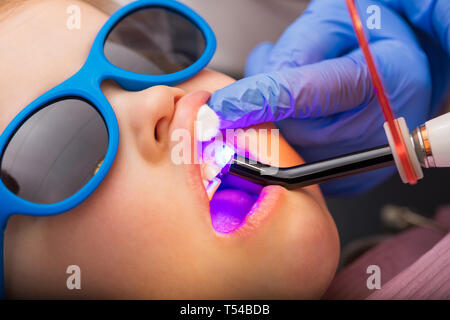 Dentist using dental LED curing light for polymerization of composite ...