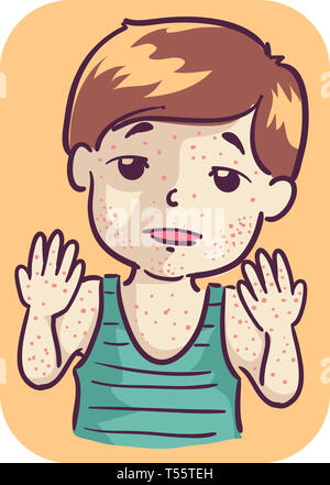 illustration of a boy with a rash Stock Photo - Alamy