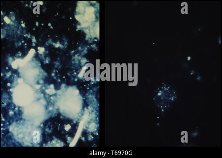 Photomicrograph of Bacillus anthracis (anthrax) spores Stock Photo - Alamy
