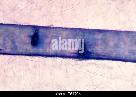 Micrograph of the hair perforation caused by the fungus Trichophyton ...