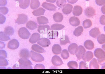 Photomicrograph of the malaria parasite Plasmodium malariae present in ...