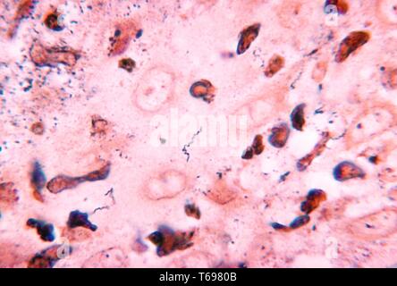 Photomicrograph of a Treponema pallidum bacterium using dark field ...