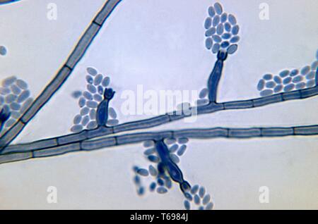 Photomicrograph of a conidia-laden conidiophore of a Phialophora ...