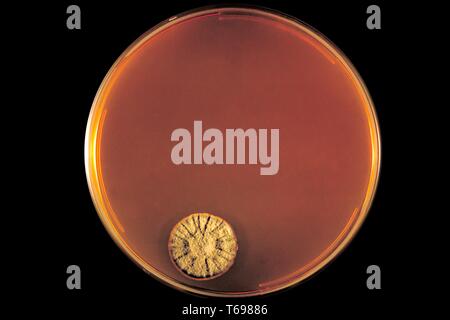 Close-up photograph of a petri dish containing a sample of Bacillus ...