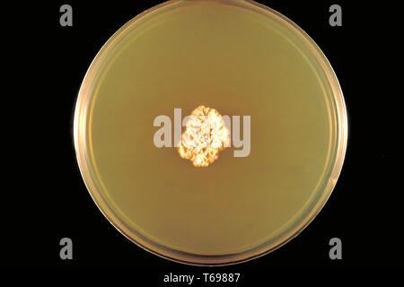 Photograph of a petri dish culture growing mixed colonies of the ...