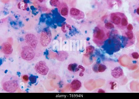 Bone tissue, light micrograph Stock Photo - Alamy