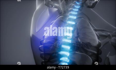Backache in Back Bones Stock Photo - Alamy