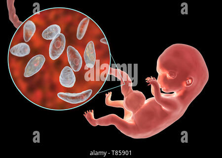 Transplacental transmission of Toxoplasmosis, illustration Stock Photo ...