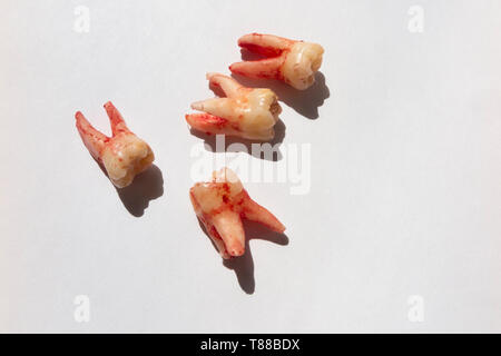 Extracted from a young child aged 9 years, these molar L6 and U6 teeth ...