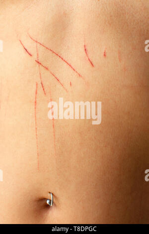 wounds on the skin cat scratches. skin with wounds.irritated skin.care ...