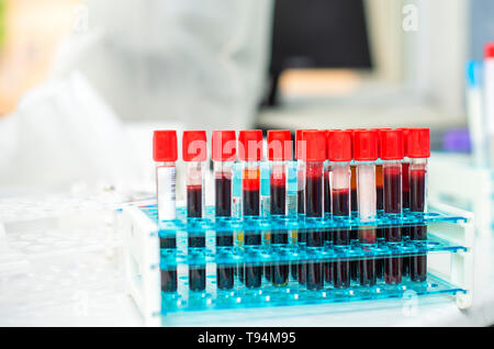 Erythrocyte sedimentation rate, blood in the Sedivetten ...