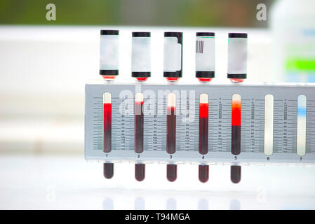 Erythrocyte sedimentation rate, blood in the Sedivetten ...