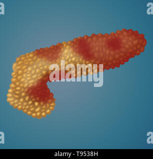 Acute pancreatitis, illustration Stock Photo - Alamy