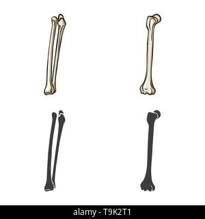broken,fibula,shin,tibia,fracture,leg,pain,femur,surgery,bone,skeleton ...
