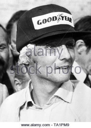 Niki Lauda after his skin grafting operation following his crash in the ...