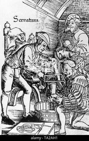 Amputation of a leg, 16th century, Amputation eines Beines im 16 Stock ...