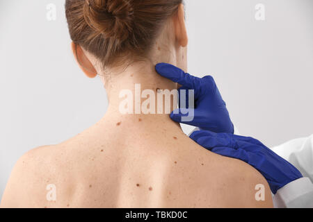Dermatologist examining moles of patient on light background. Banner ...
