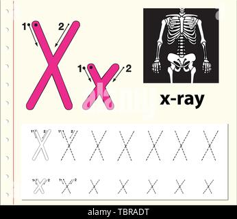 Illustration of a letter X is for x-ray Stock Vector Image & Art - Alamy