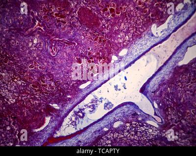 Sheep lung parasitized by lung worms Stock Photo - Alamy