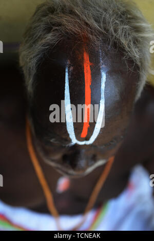 A Vaishnavite Brahmin wearing a Urdhva Pundra tilak on his forehead ...