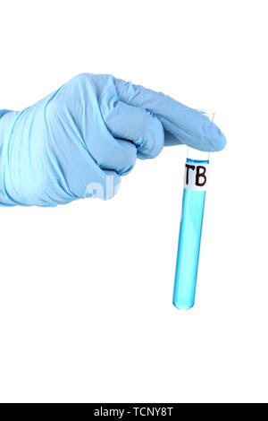 Test tube labeled Tuberculosis(TB) isolated on white Stock Photo - Alamy