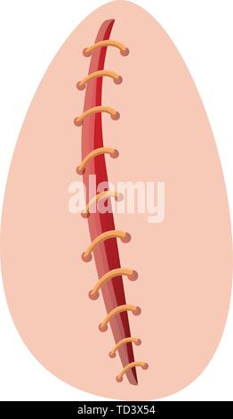 Medical suture concept background. Cartoon illustration of medical ...