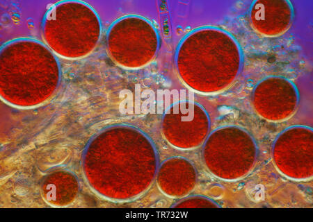 Haematococcus algae. Differential interference contrast (DIC ...