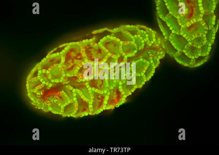 lily (Lilium spec.), pollen of a lily, Phase contrast microscopy, x 100 ...