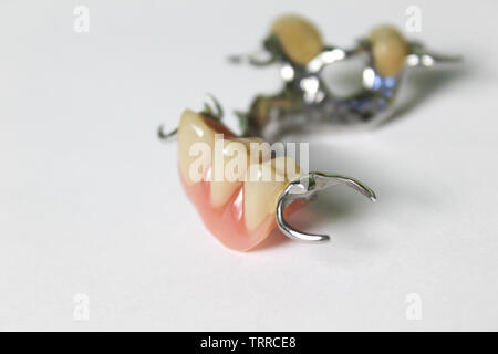 Removable partial denture metal and plastic dental false teeth Stock ...