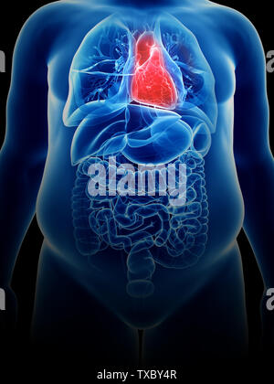 Fatty heart in overweight man, illustration Stock Photo - Alamy