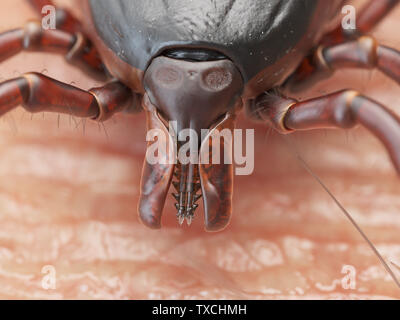 Illustration of a tick crawling on human skin Stock Photo - Alamy