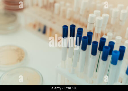 top view of medicine test tubes with blood samples over blue background ...