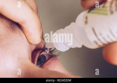 a man drips open human eye with bright red arteries drops to improve ...